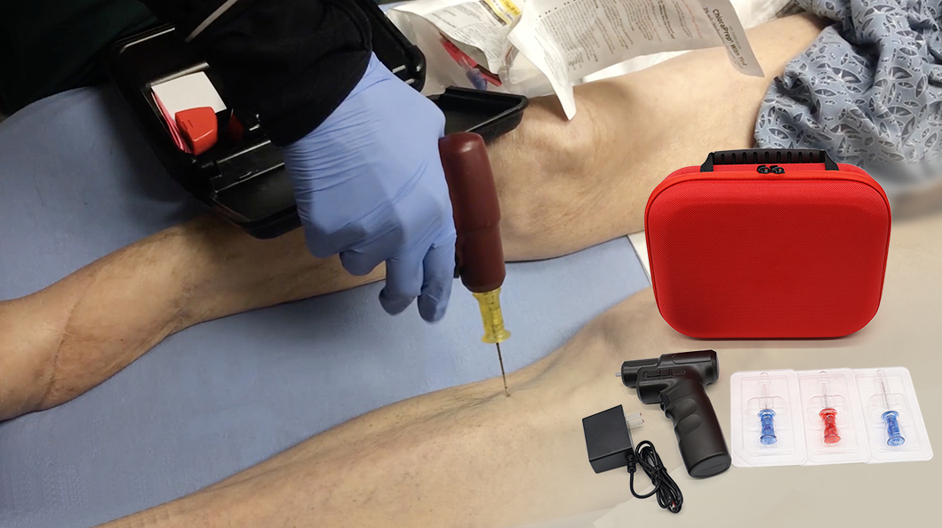 Medical Electric Orthopedic Intraosseous Infusion System Puncture ...